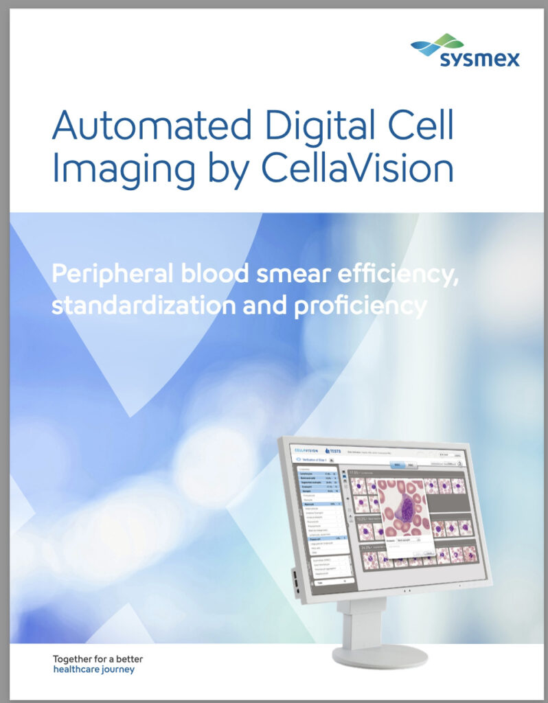 Automated Digital Cell Imaging by CellaVision – Sysmex Print Inventory